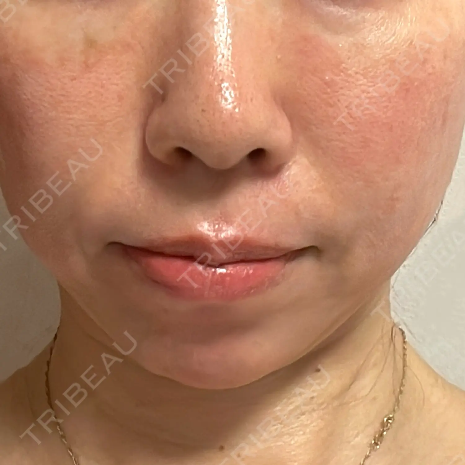 《BISIN GINZA CLINIC》口コミ・症例584件掲載「ネット予約可」 | トリビュー