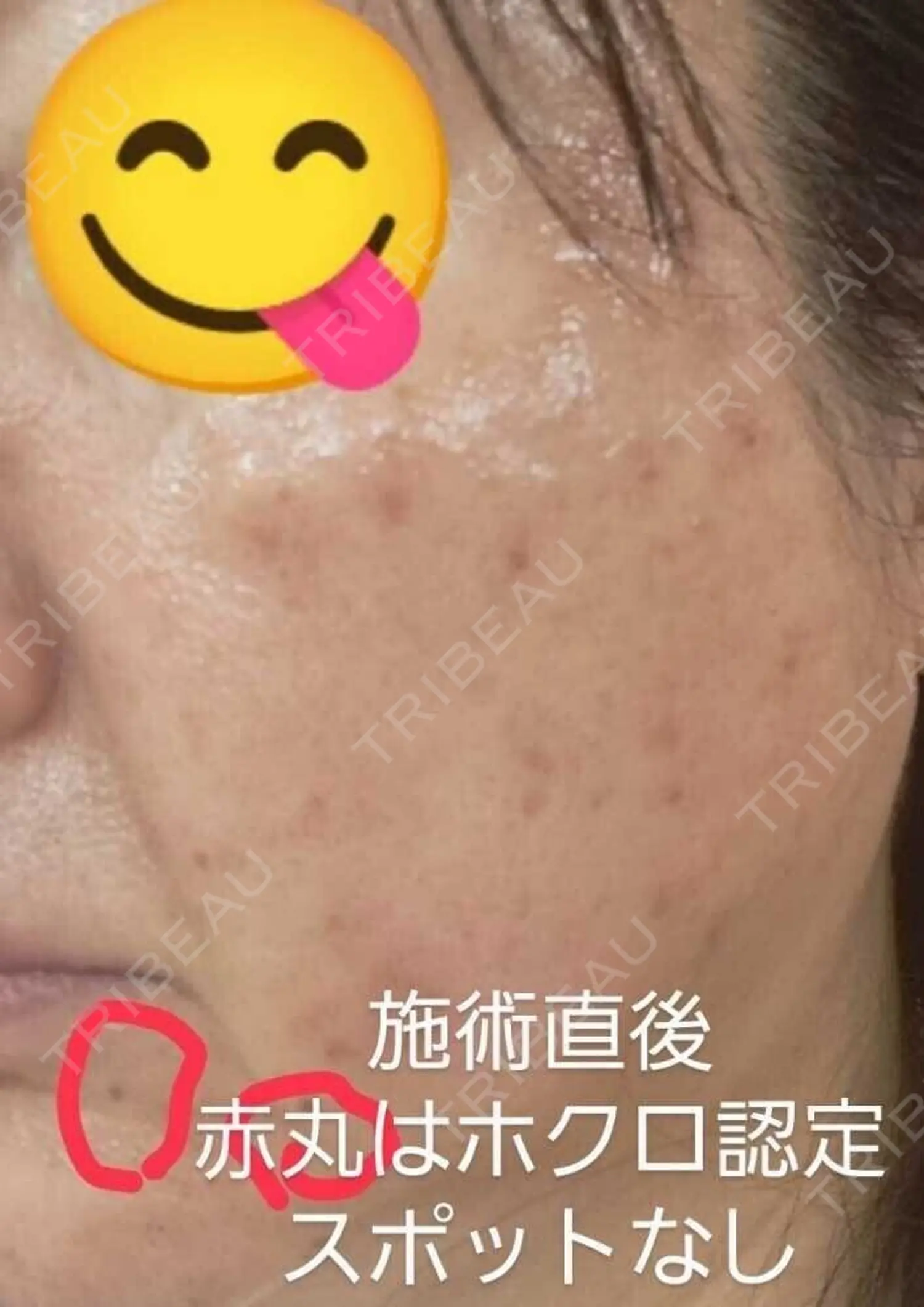 《BISIN GINZA CLINIC》口コミ・症例1065件掲載「ネット予約可」 | トリビュー